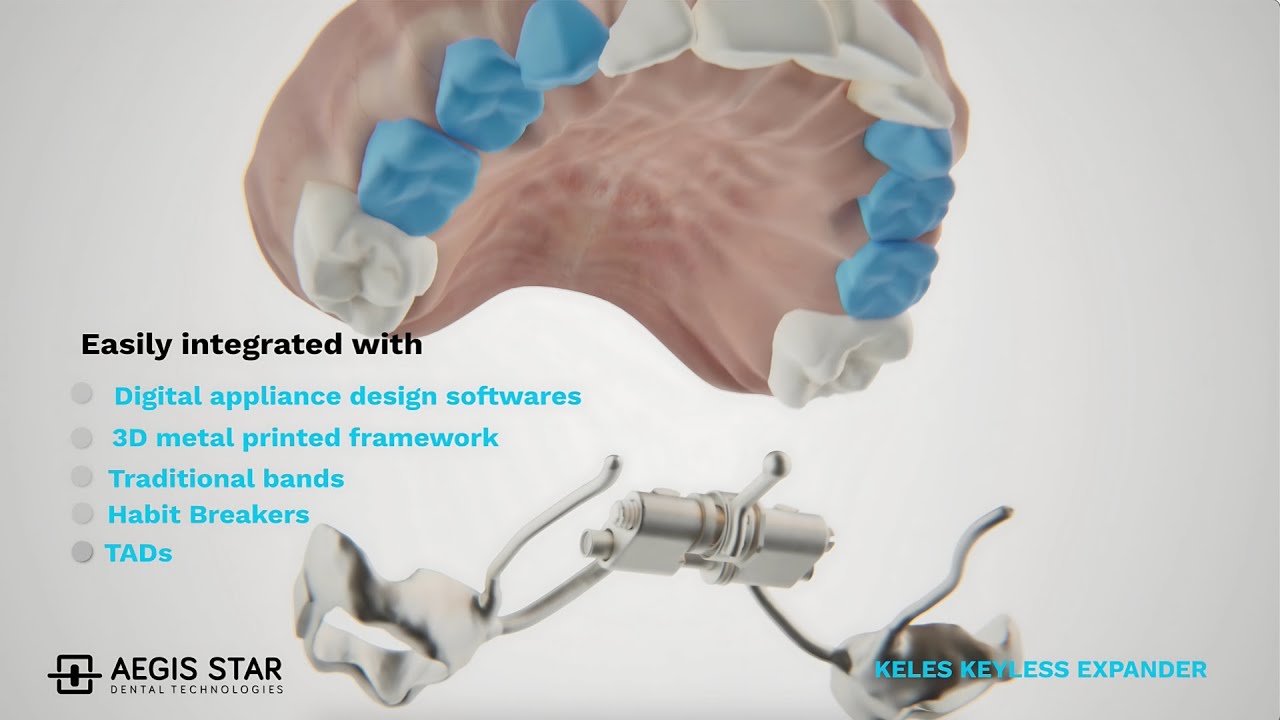 Different Designs of the Keles™ Keyless Expander - YouTube