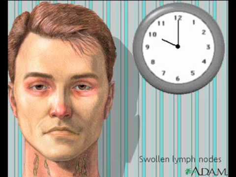 Lymph nodes - Anatomy Video -