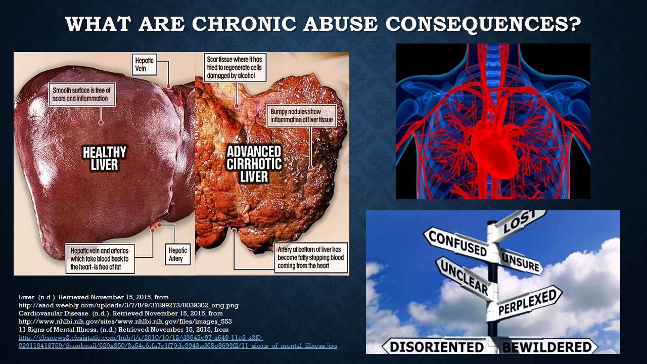 HEA 331-01: Alcohol Abuse PSA - YouTube