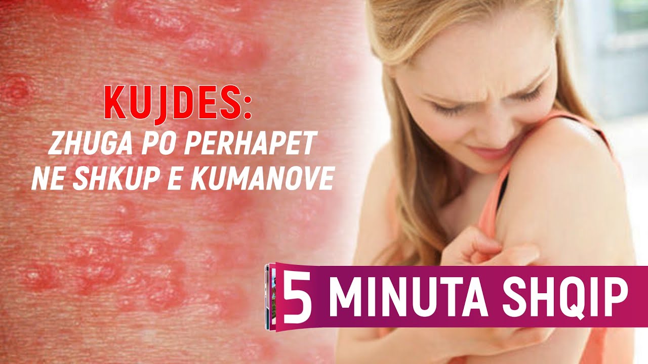 Shpërthen zgjeba (zhuga) në Shkup e Kumanovë - YouTube