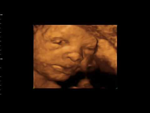 3D 4D Ultrasound baby scan. The Original Window to the Womb Ltd - YouTube
