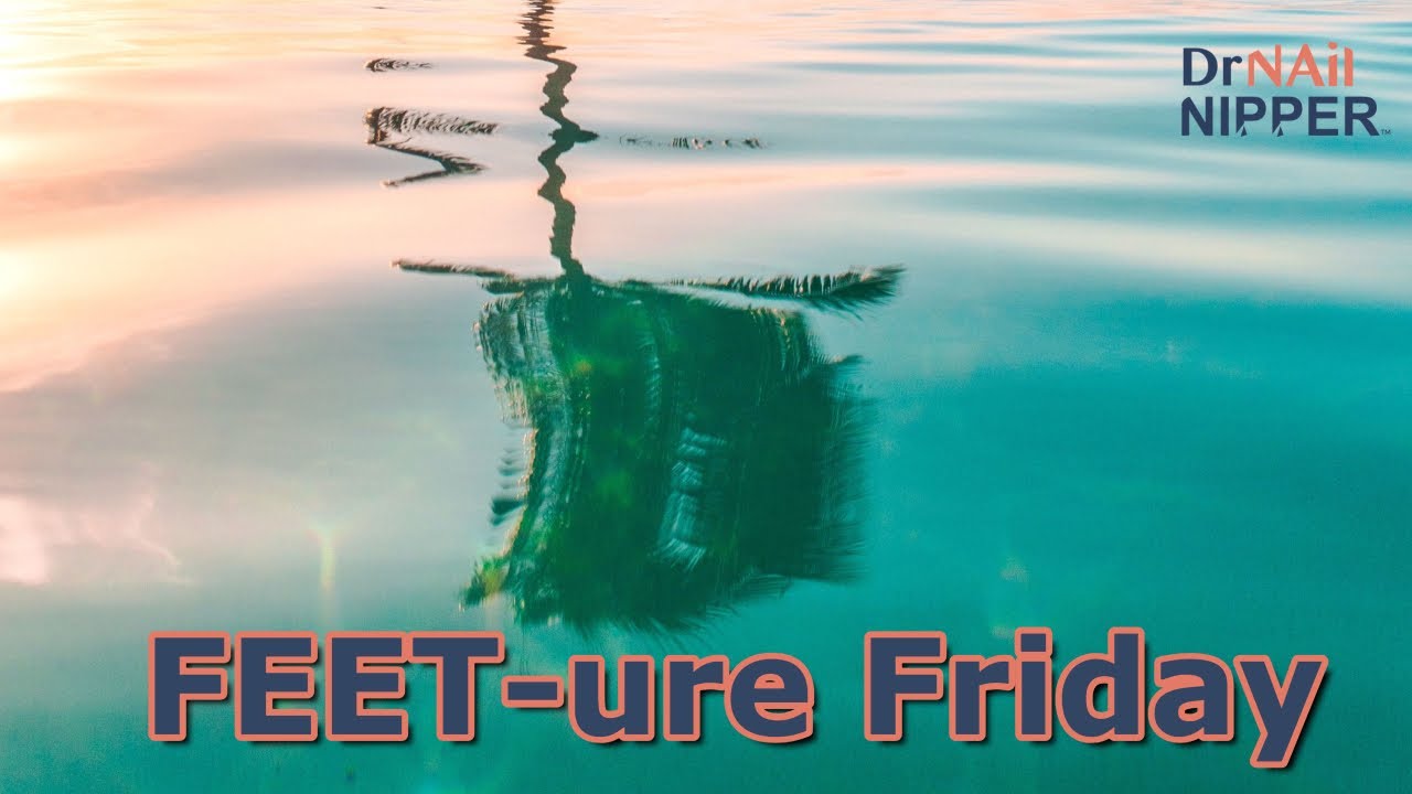 FEET-ure Friday | She Has Gout, But Not in Her Foot - YouTube
