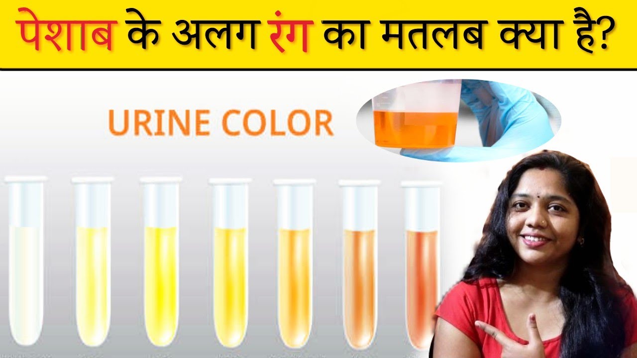 पेशाब का रंग पीला क्यों होता है? Peshab ka rang lal kyu hota hai/ Urine ...