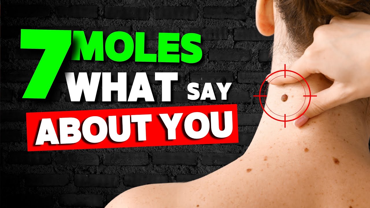 How to Decode the Meaning of Moles on 7 Body Parts: Unveiling Hidden ...