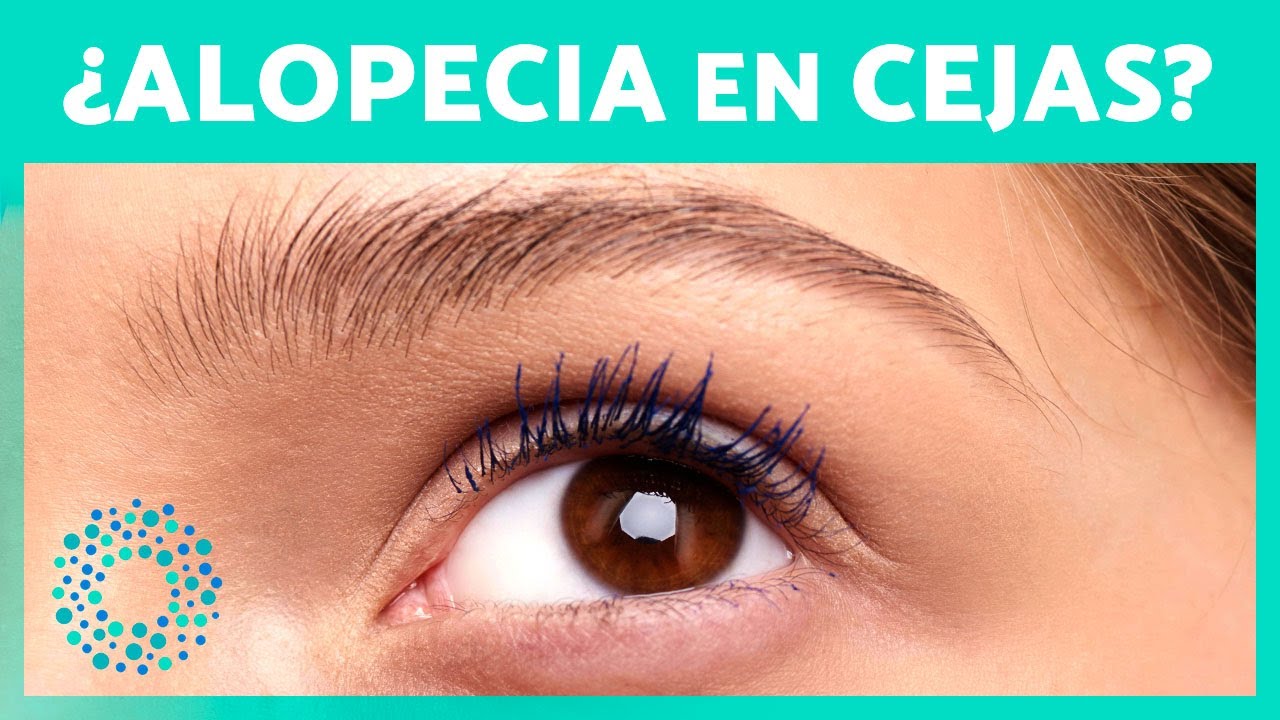 ¿Por qué se CAE el PELO de las CEJAS? 👩🏼‍🦲 (6 Causas de la Pérdida de ...