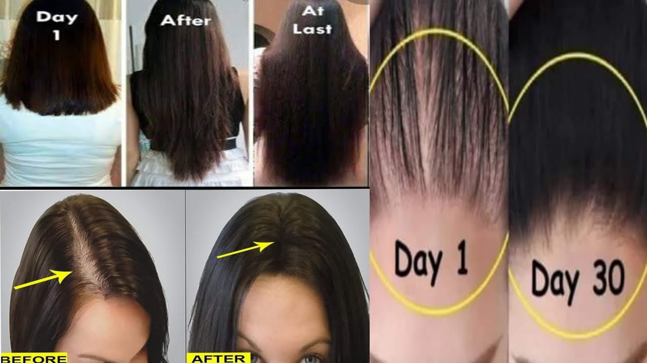 A Recipe that helps to Strengthen hair & Promote hair growth, Only one ...