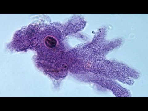 Nutrition in Amoeba / Feeding and Digestion in Amoeba / How amoeba eats?