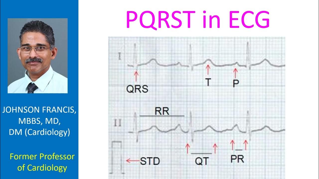 PQRST in ECG - YouTube