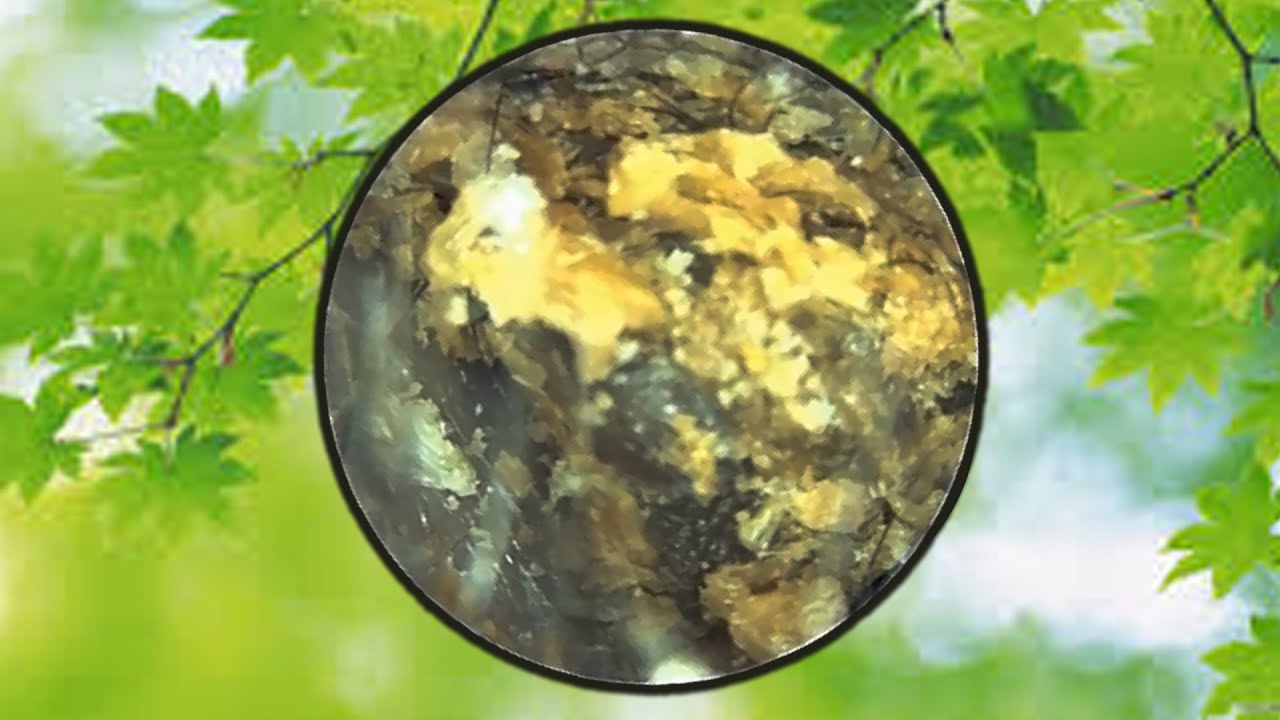 耳垢除去デブロックス ear wax removal de brox Part 279 - YouTube