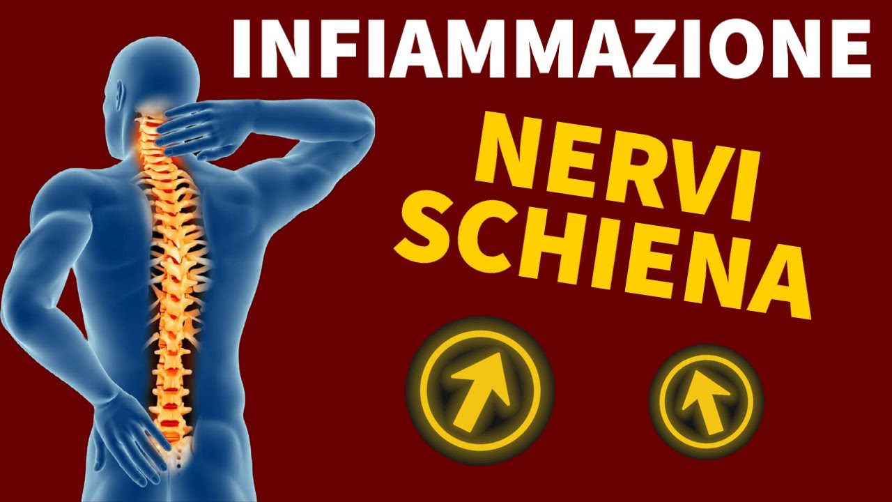 Come Sfiammare I Nervi Della Schiena? - YouTube