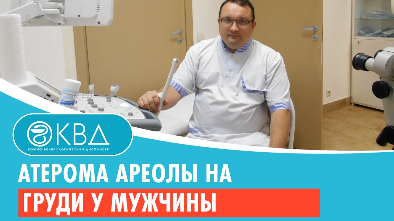 👉 Атерома ареолы на груди у мужчины. Клинический случай №848 - YouTube