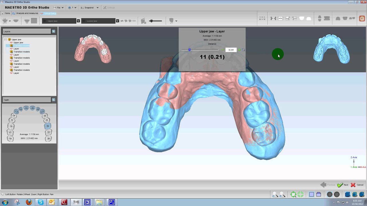 Ortho Studio - Part 10. Layers, sequencing of objectives - YouTube