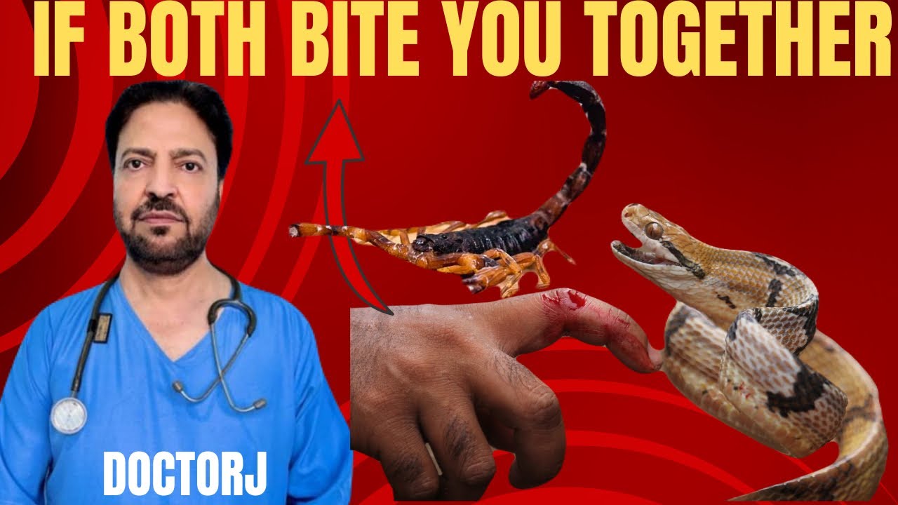 What Happens if Snake And Scorpion Bites You Simultaneously | DOCTORJ ...