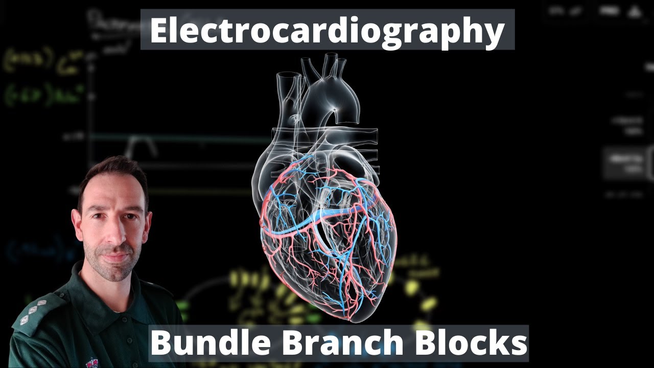 ECG - Bundle Branch Blocks Explained - YouTube
