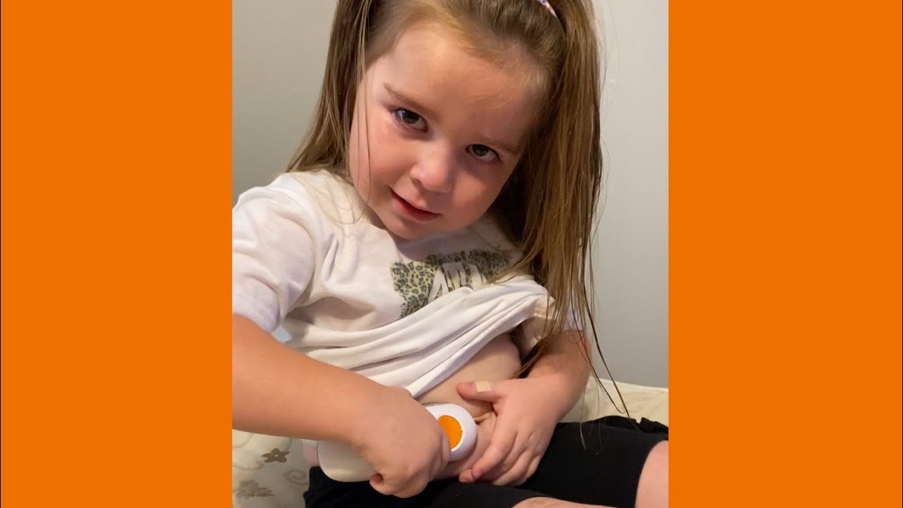 3 year old changes dexcom - YouTube