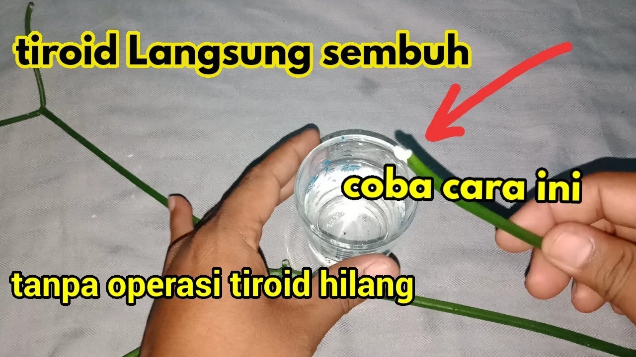 DOKTER TERKEJUT!! cara mengobati penyakit tiroid pada leher secara ...