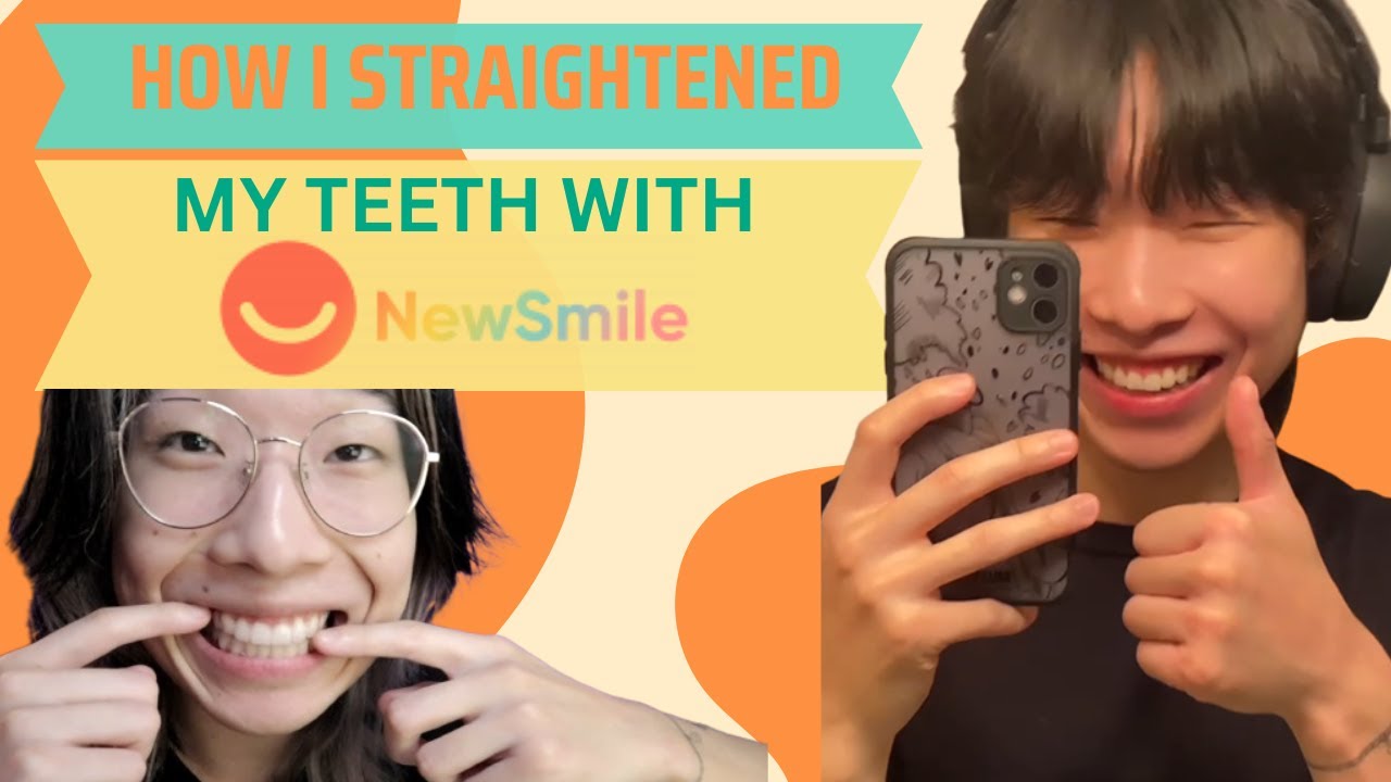 Billy Han's NewSmile Journey | Honest Invisible Aligner Review - YouTube