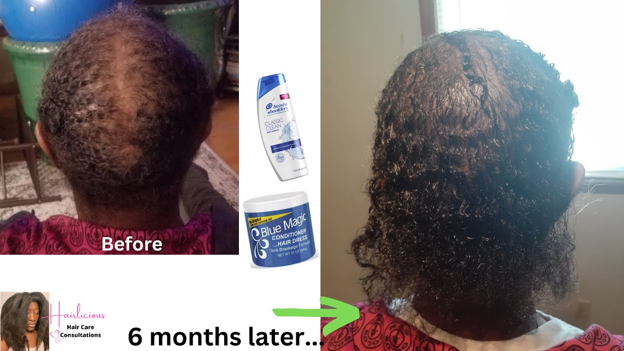 She Thought Her Natural Hair Couldn't Grow |Listen to Consultation ...