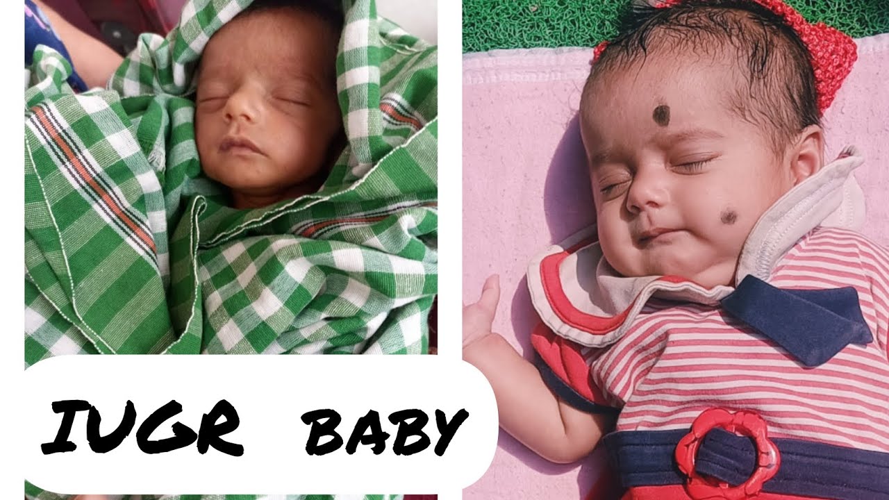 MY IUGR baby experience। intrauterine growth restriction - YouTube