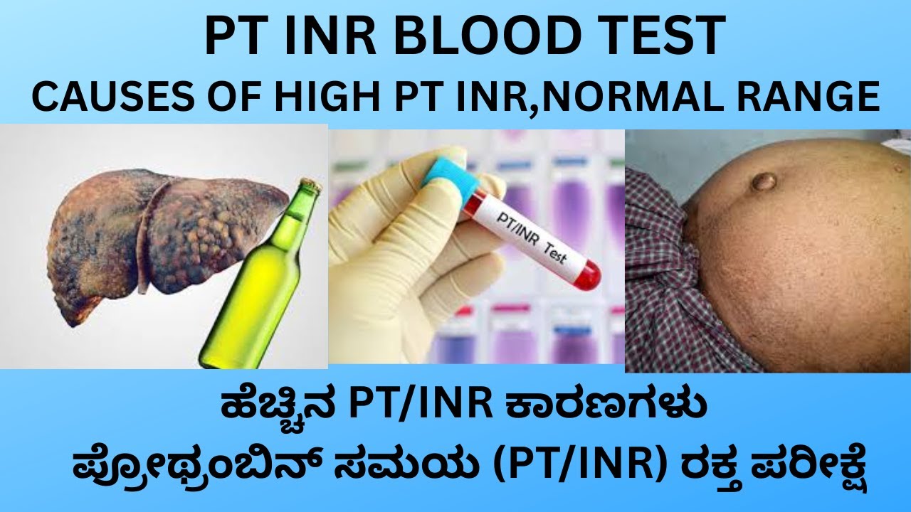 PT INR HIGH.PT INR BLOOD TEST NORMAL RANGE,CAUSES OF HIGH PT INR IN ...