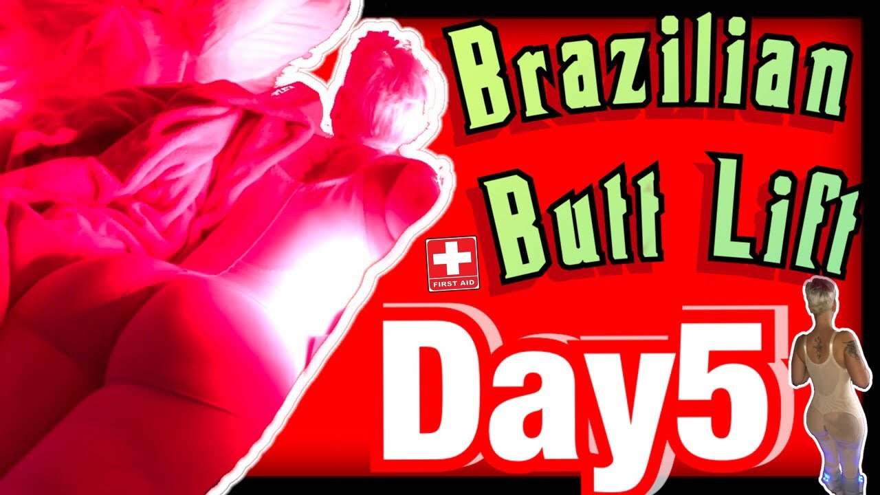 BRAZILIAN BUTT LIFT (BBL) MY SURGERY EXPERIENCE | DAY 5 - YouTube