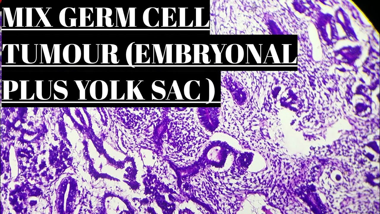 Embryonal Carcinoma Cells