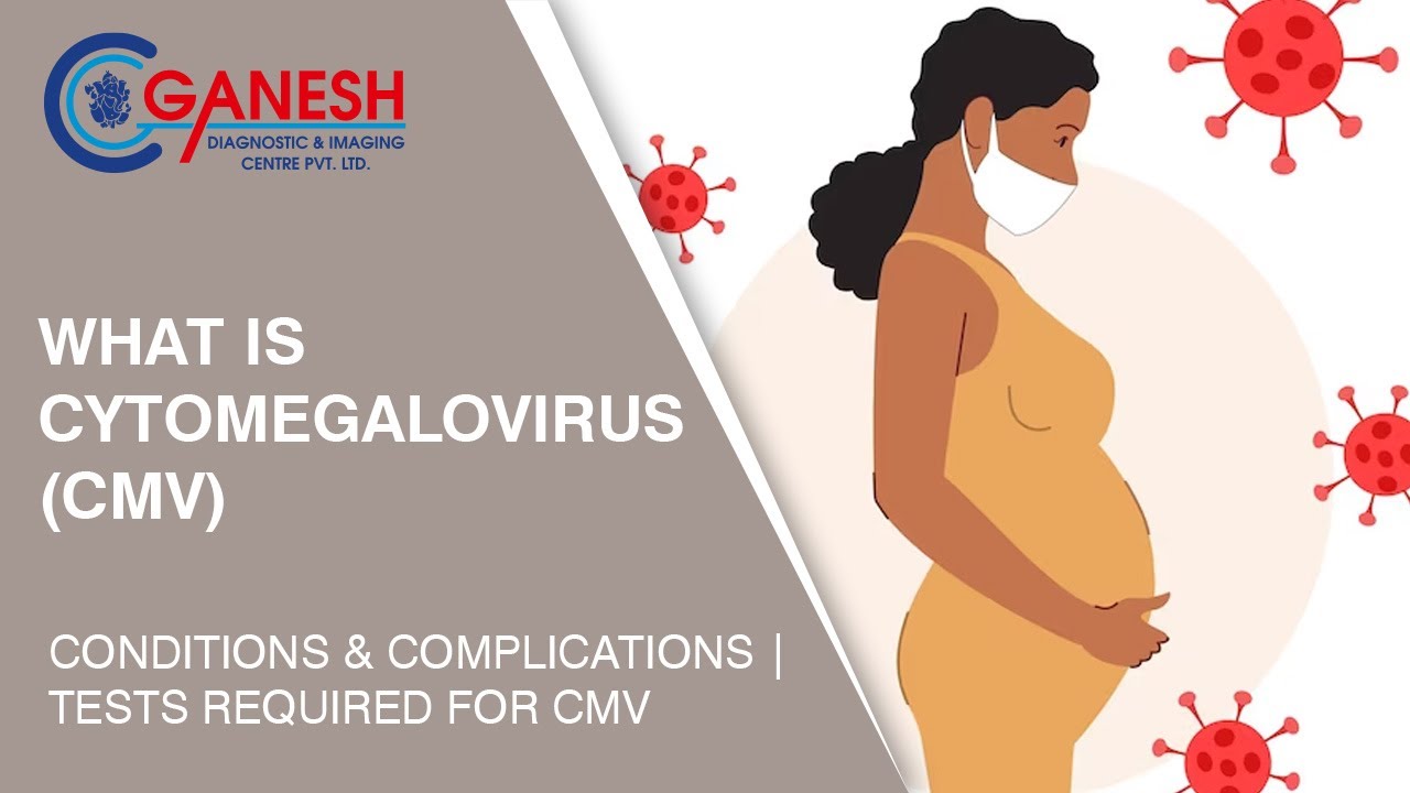 what is Cytomegalovirus (CMV)- conditions & complications | Tests ...
