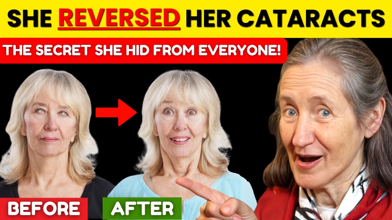 REVERSE CATARACTS IN 30 DAYS WITH THESE 30 HABITS - YouTube