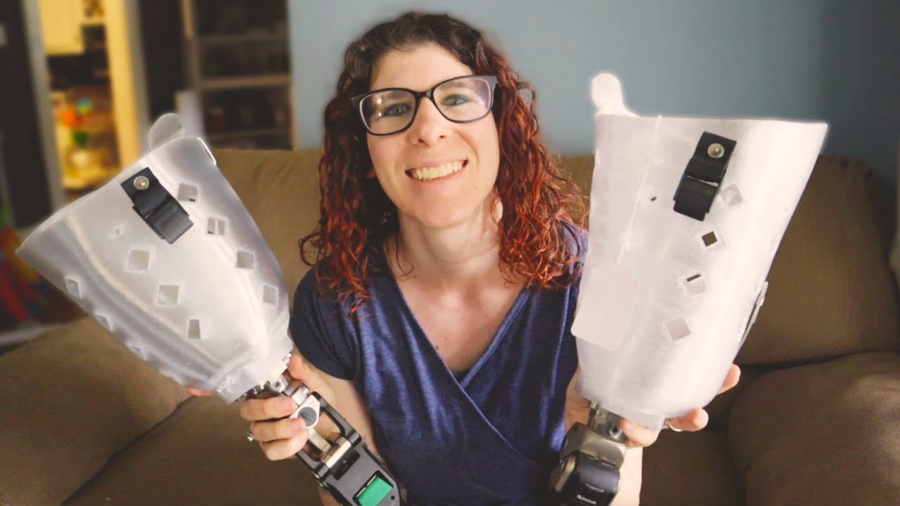 Bilateral Above Knee Amputee | Check Socket Set-Up - YouTube