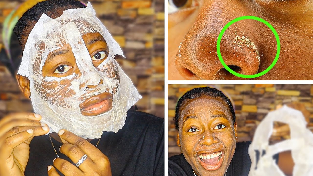 Shocking Easy DIY Blackheads And Whitehead Removal Peel Off Mask. - YouTube