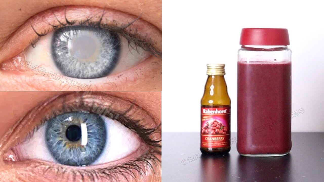 DRINK THIS 2 TIMES A WEEK AND STOP WEARING GLASSES IMPROVE EYESIGHT drink-this-2-times-a-week-and-stop-wearing-glasses-improve-eyesight