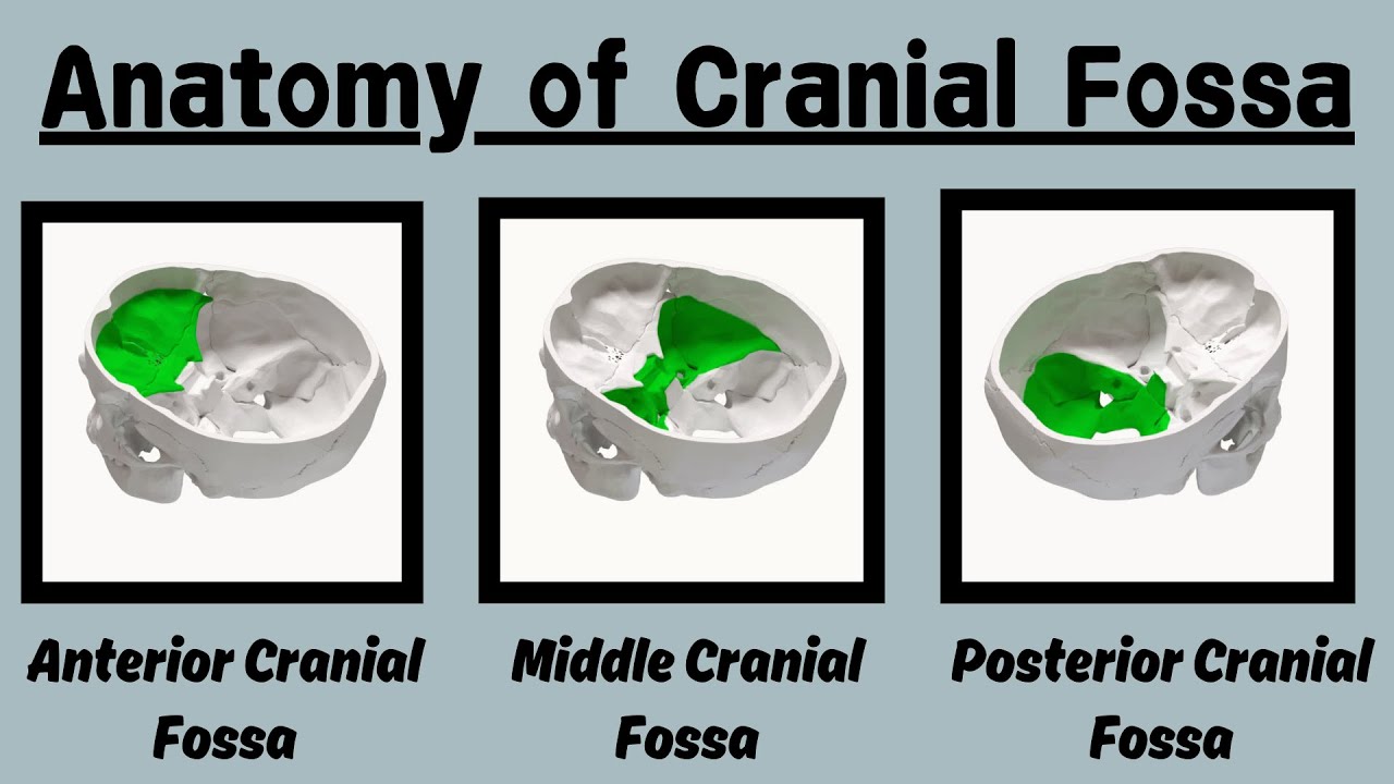 Cranial Fossa Labelled | anterior cranial fossa, middle cranial fossa ...