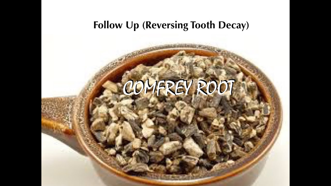 Follow Up (Reversing Tooth Decay) Comfrey Root - YouTube