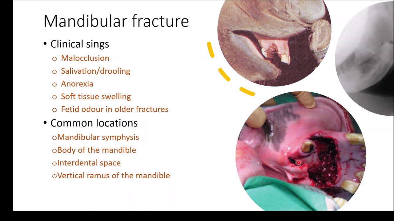 Tongue, mandibular fracture fistulous withers - YouTube