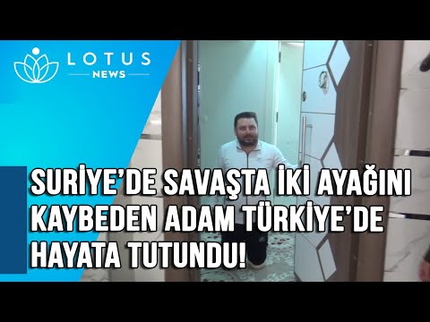 SURİYE'DE SAVAŞTA İKİ AYAĞINI KAYDEBEN ADAM, TÜRKİYE DE HAYATA TUTUNDU!