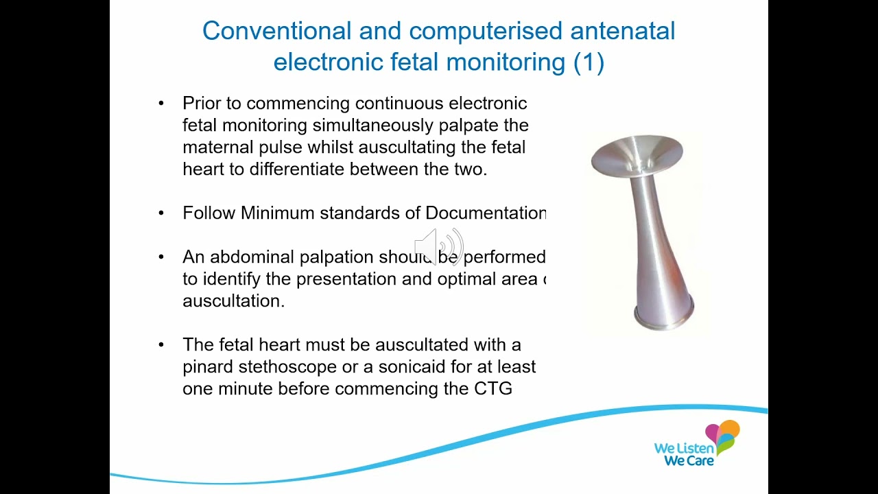 Antenatal and Intrapartum CTG - YouTube
