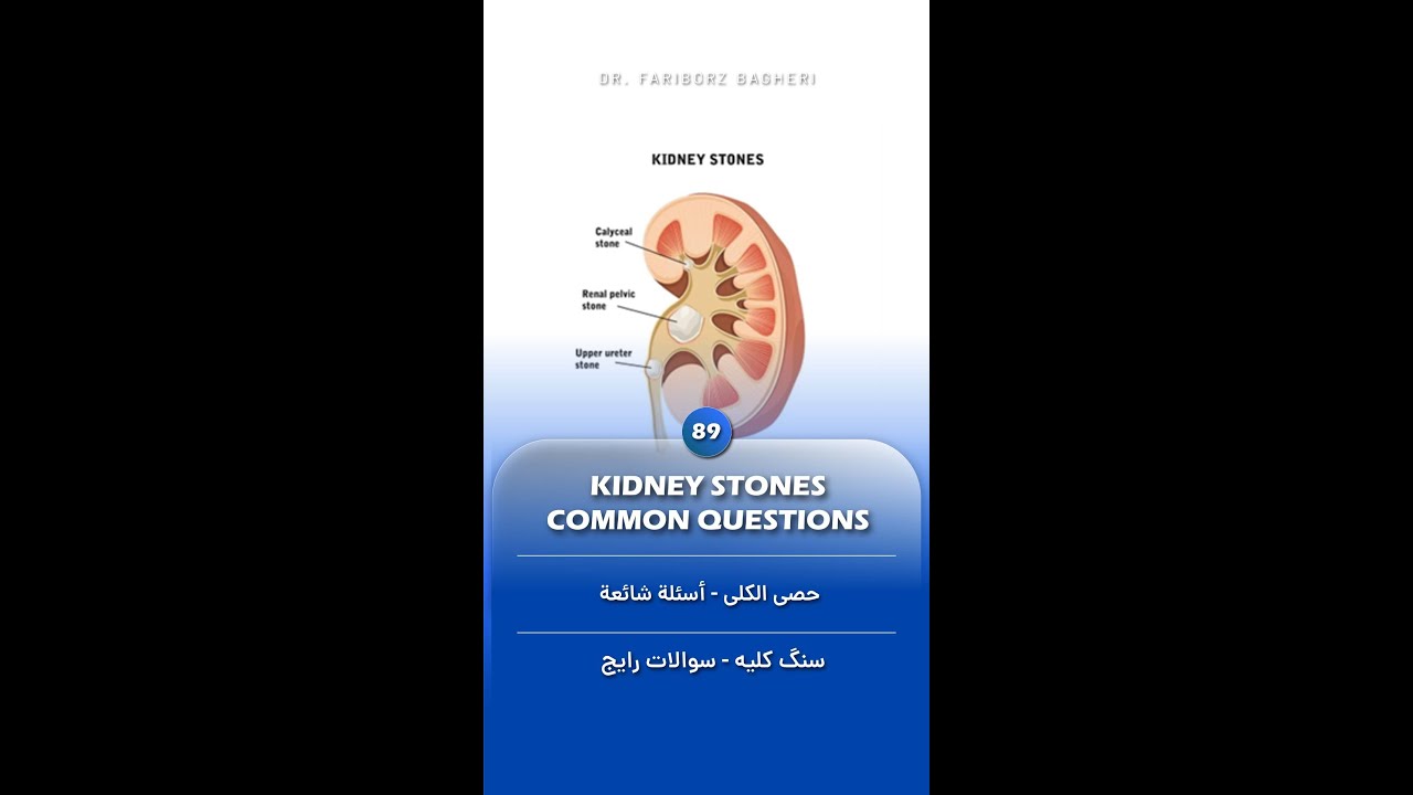 Video 89: Kidney Stones – Common Questions - YouTube