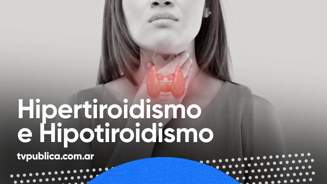 Hipertiroidismo e Hipotiroidismo: ¿Cuáles son los Síntomas? - Mañanas ...