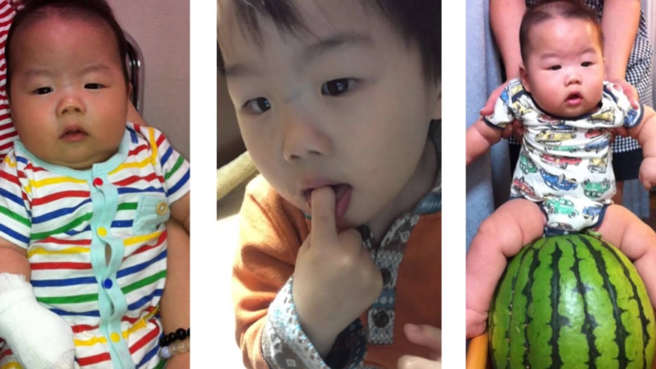 Children with Type II and Type III Gaucher Disease in Japan - YouTube