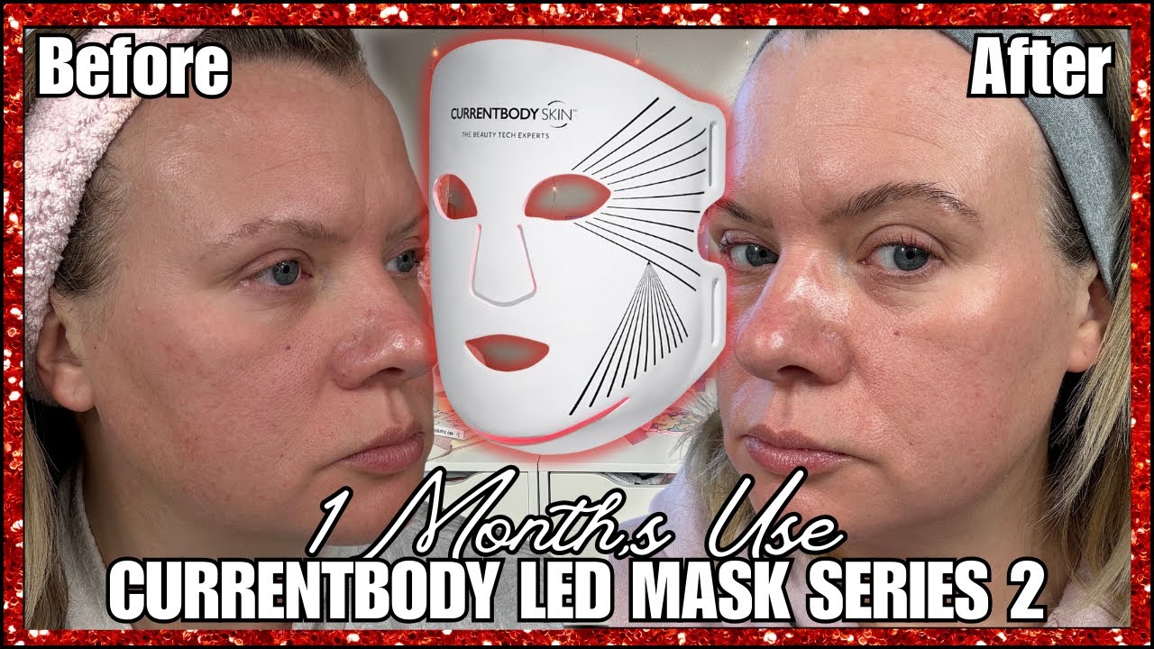 CurrentBody Skin LED Mask Series 2 Full Honest Review + Before & After ...