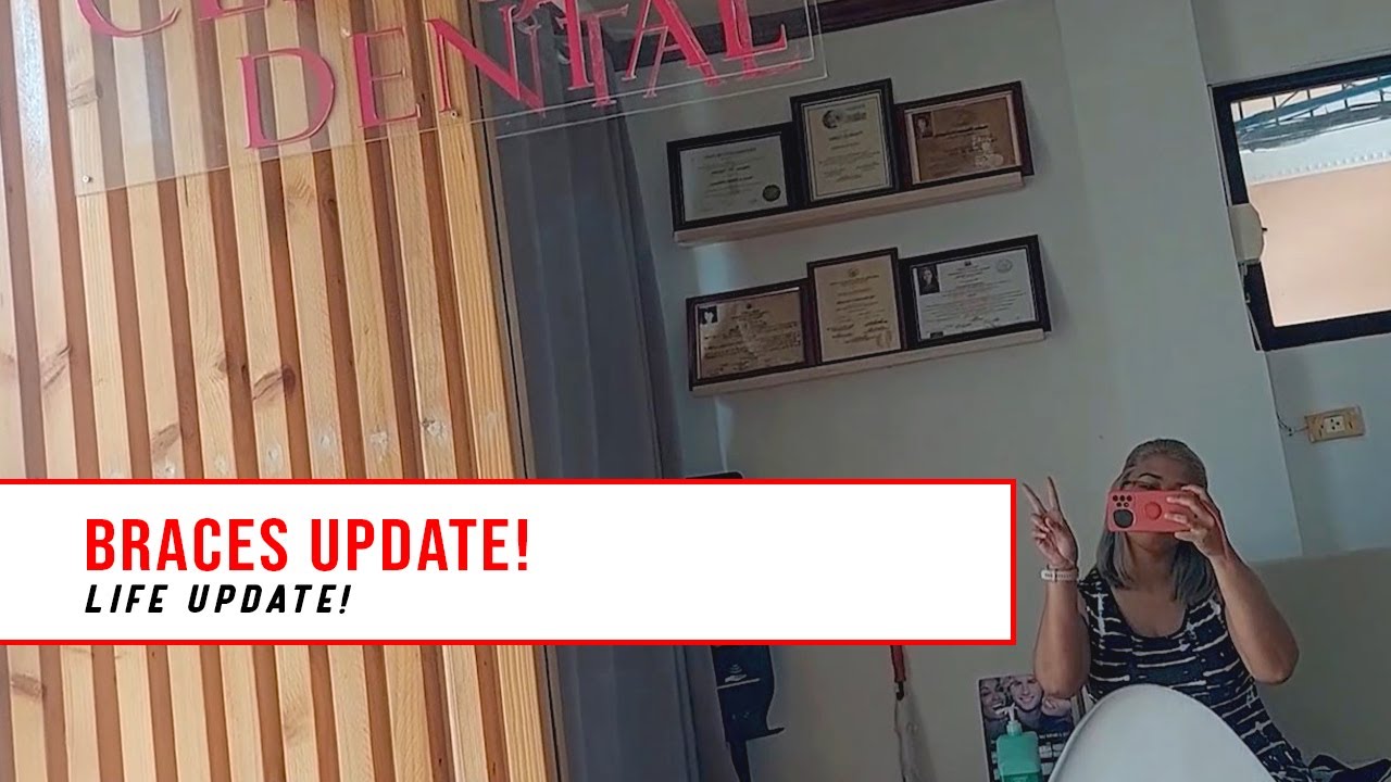 Braces Update | Got My Lower Braces Installed - YouTube