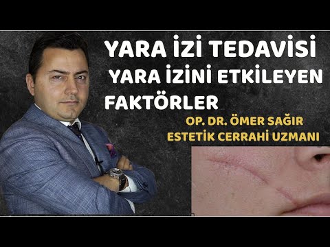 Yara İzi Tedavisi (GÜNCEL VE BİLİMSEL TEDAVİ)
