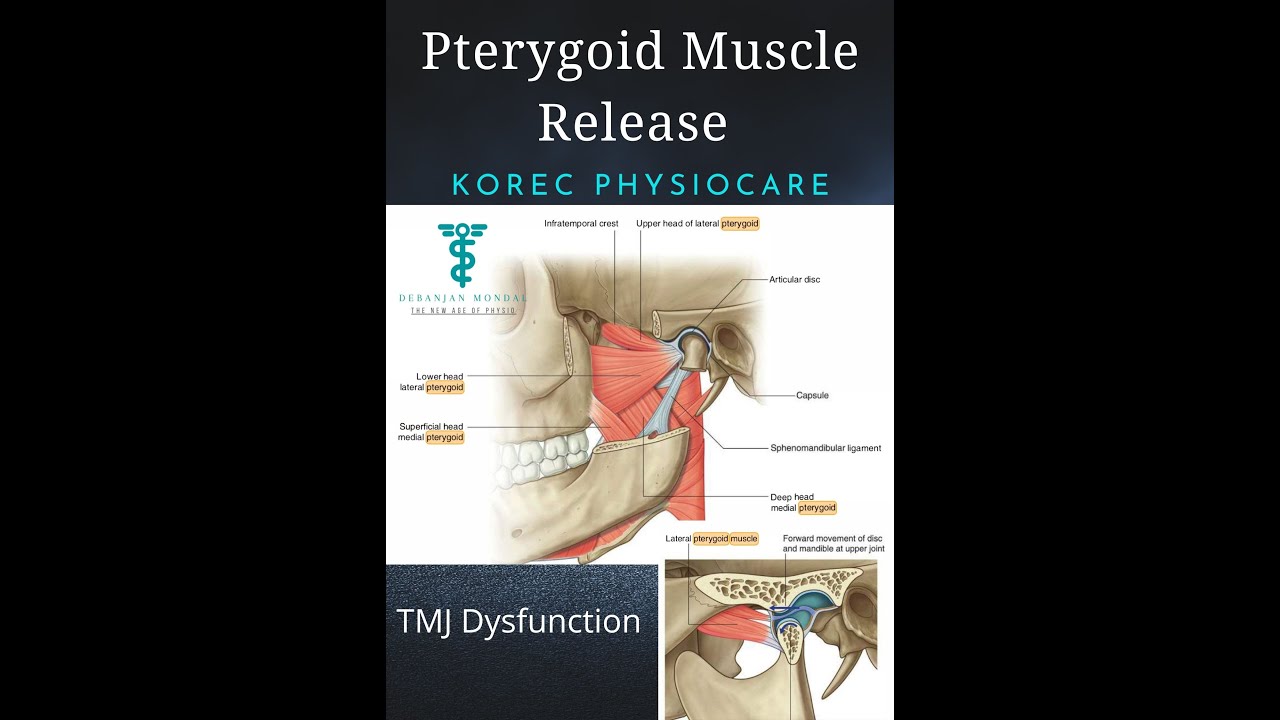 Pterygoid Muscle Release For Temporomandibular Joint Dysfunction (TMJ ...