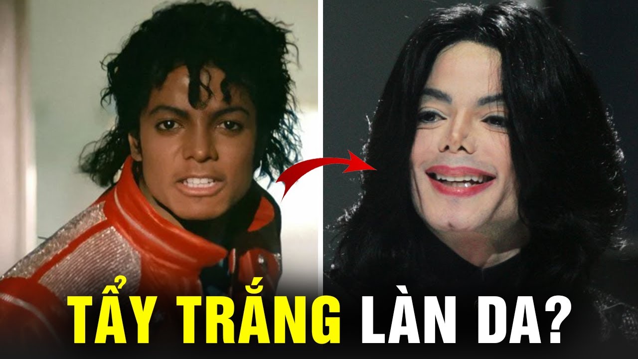 Vì Sao Da Của Michael Jackson Lại Đổi Màu? | Tẩy trắng da hay mắc bệnh ...