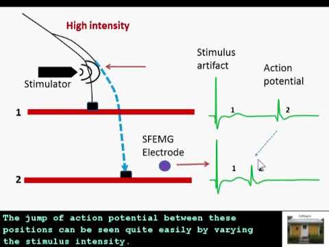SFEMG - Axon Reflex (Erik Stalberg) - YouTube