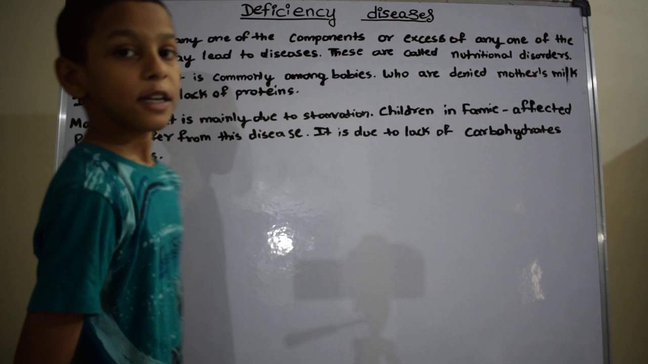Deficiency diseases | Biology - YouTube