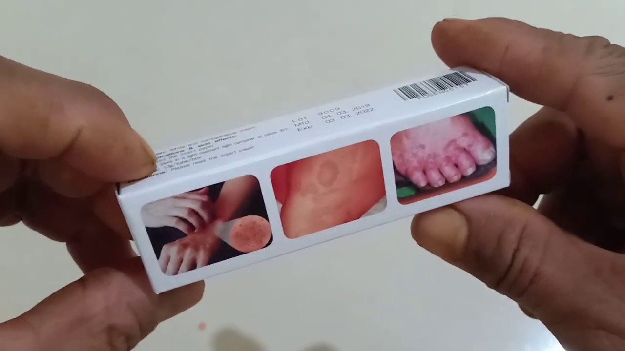 Very itchy how! Use this posen cream to relieve itching - How much ...