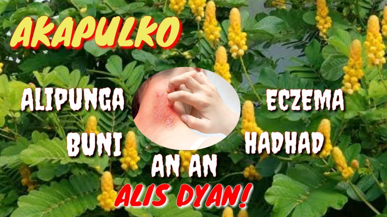 AKAPULKO HALAMANG GAMOT ANTI FUNGAL PLANT Tenrou21 YouTube AKAPULKO HALAMANG GAMOT ANTI FUNGAL PLANT Tenrou21 YouTube