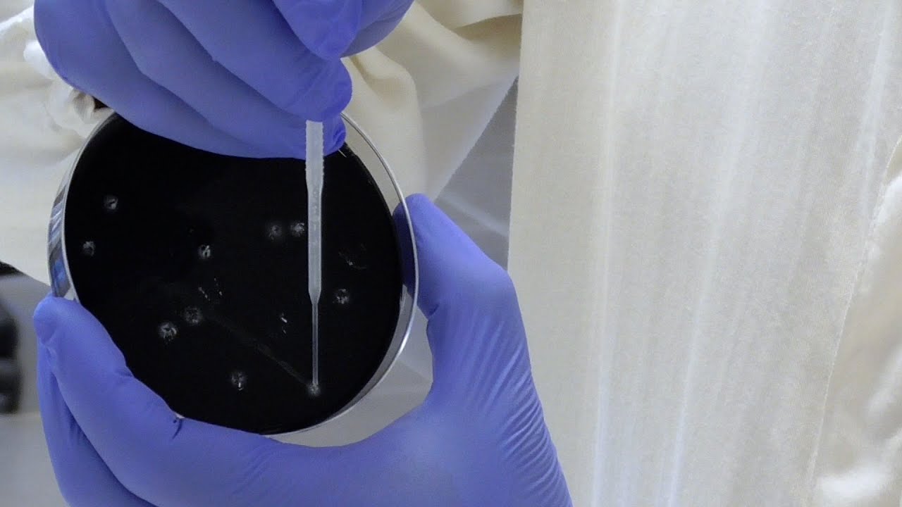 Identificazione di colonie di Legionella via Real-Time PCR - YouTube