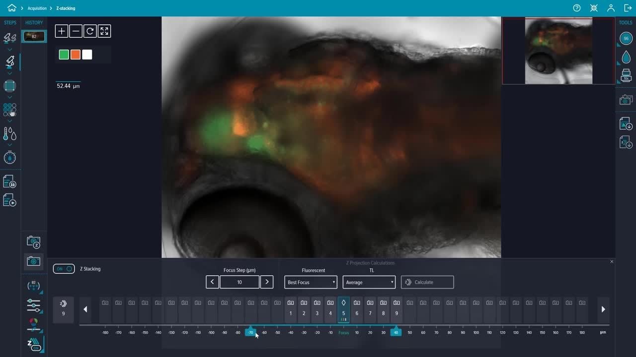 How to perform a z-stack image acquisition using CellReporterXpress ...